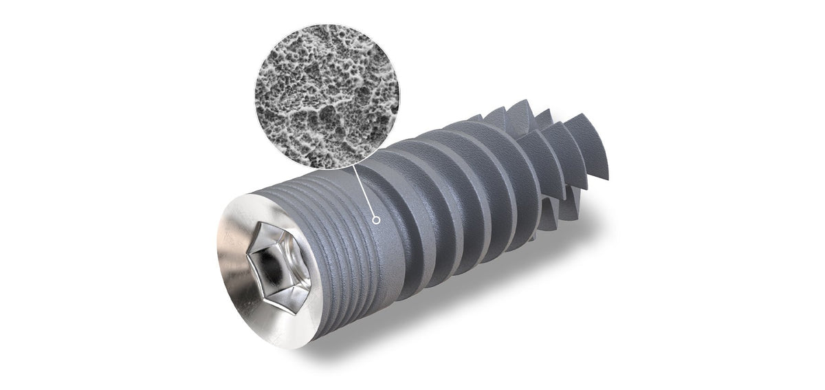 Dental Implants SLA Surface Treatment – WholeDent