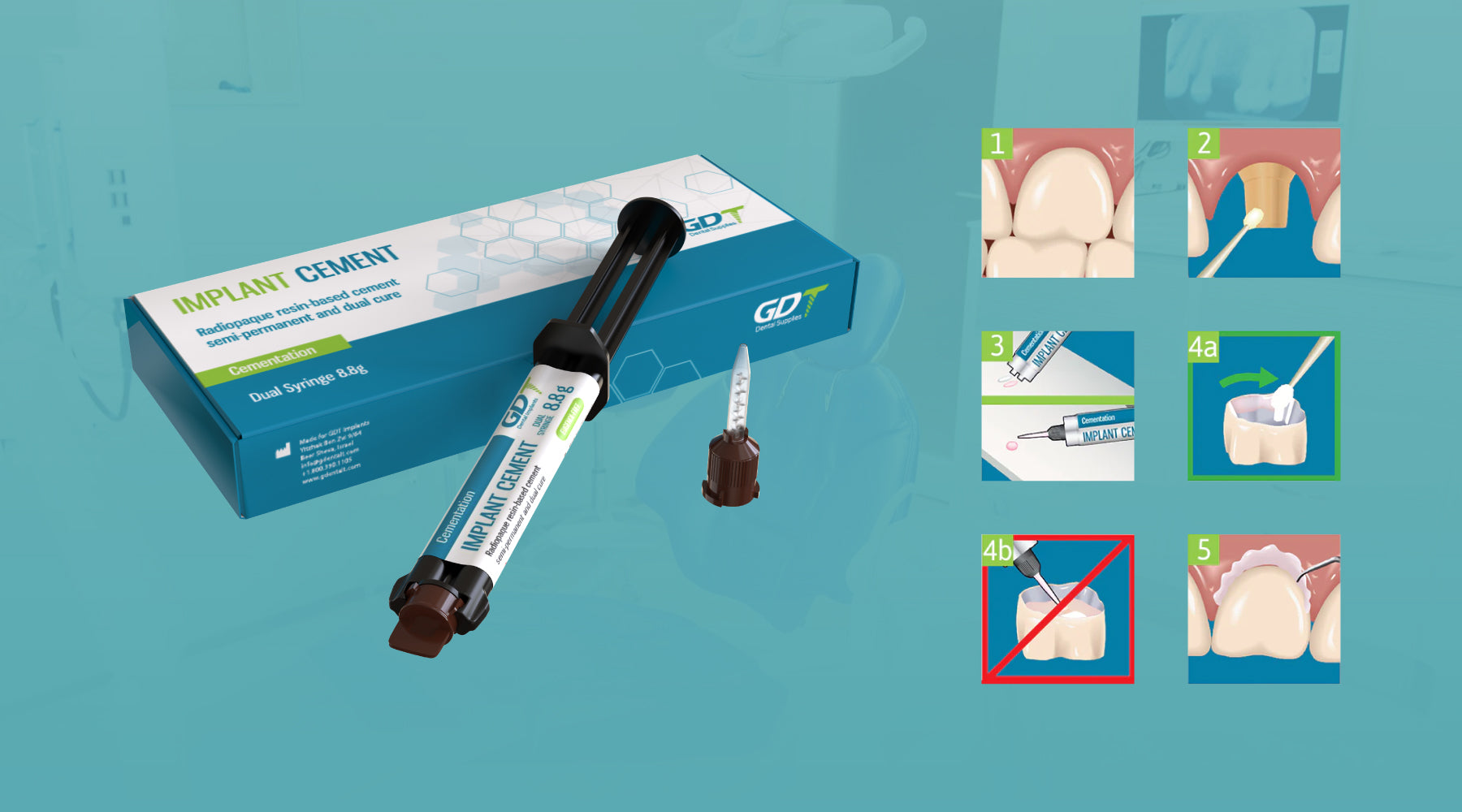 Dental Implant Cementation: Ensuring Crown Longevity with GDT Implant – WholeDent