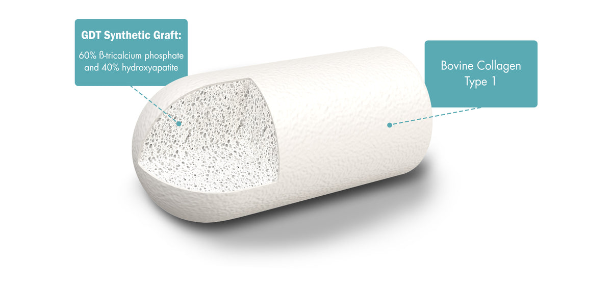 GDT Sponge Grafting Plug – WholeDent