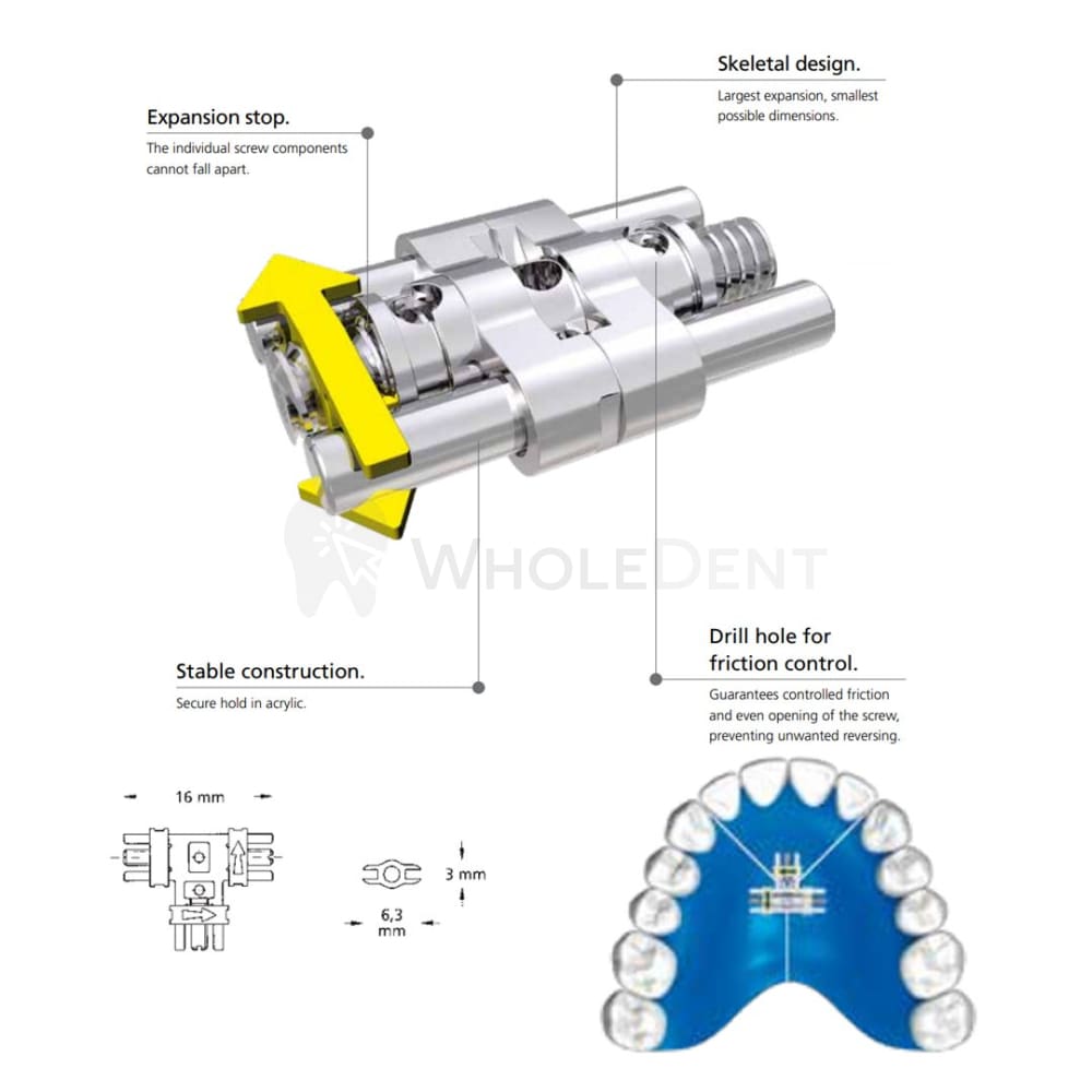 Dentaurum Three Dimensions Bertoni Expansion Screw – WholeDent