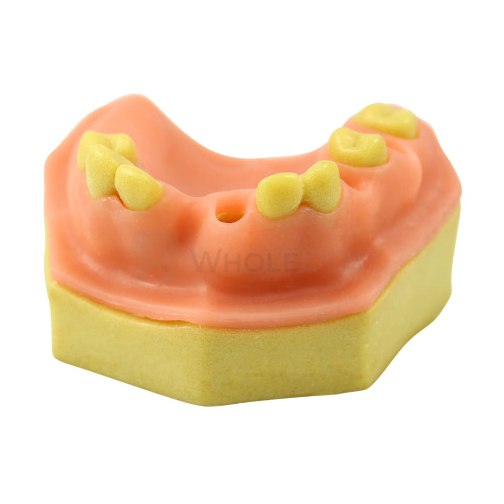 EasyinSmile Upper Jaw Model With Missing Teeth – WholeDent