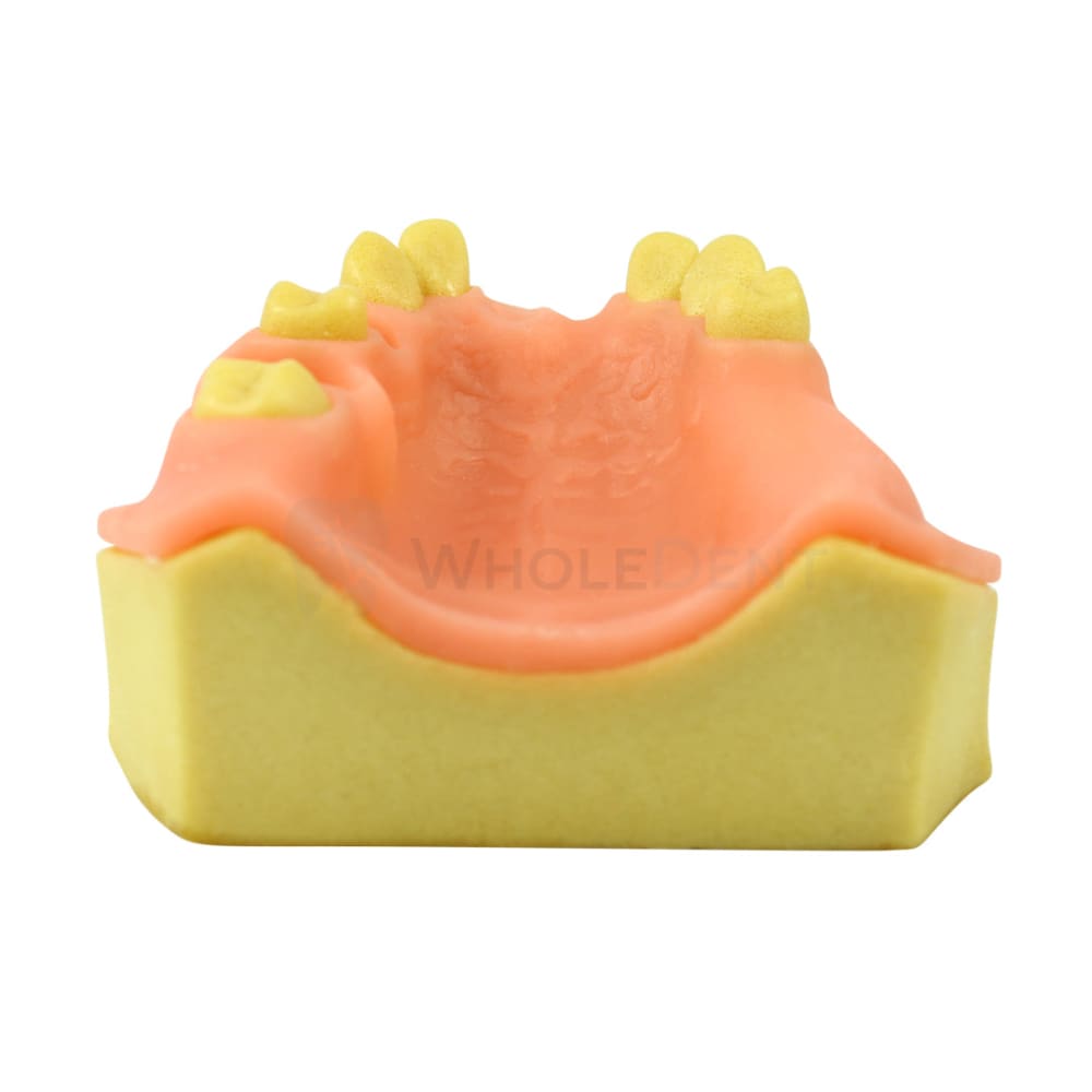 EasyinSmile Upper Jaw Model With Missing Teeth – WholeDent