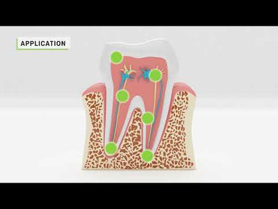 MEDICLUS One-Fil®Putty Multi Purpose Bioceramic Cement – WholeDent
